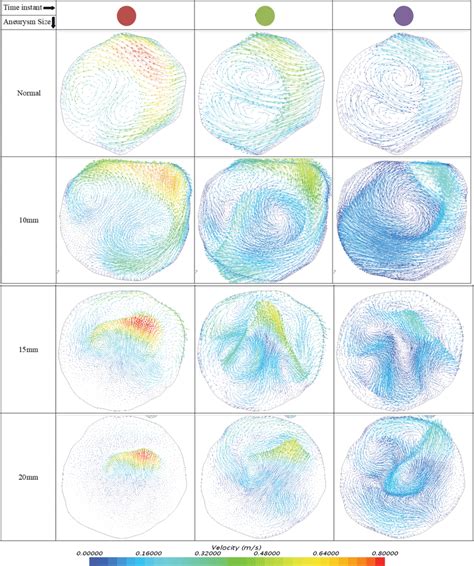 Velocity Pattern Along X‐y Plane At Exercise Condition Download Scientific Diagram
