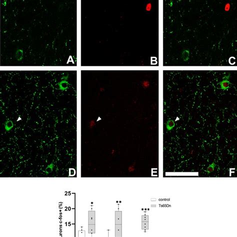 Senescence Of Cholinergic Neurons In The Ts65dn Mouse Model Download Scientific Diagram