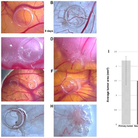 A375 Melanoma Cell Graft And Tumor Formation On Chick Embryo