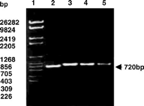Pcr Assay For Detection Of Brucella Melitensis In Milk Samples Lane 1 Download Scientific
