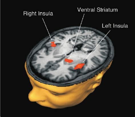 Results Of The Whole Brain Analysis Identifying Regions That Exhibit A