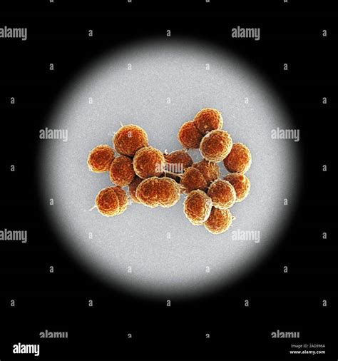 Enterococcus Faecalis Bacteria Coloured Scanning Electron Micrograph Sem Of A Clump Of