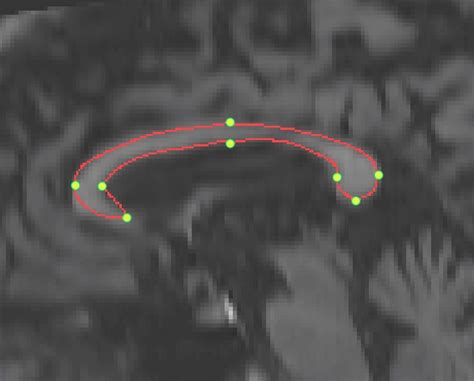 Laplacian Mesh Editing A With And B Without Landmarks Green Download Scientific Diagram