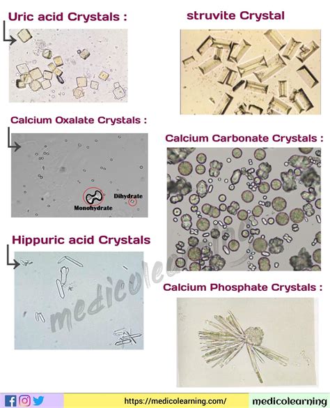 Urine Microscopy And Casts Image Atlas Key Squamous Artofit
