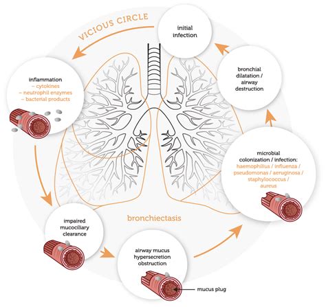 Physiology 2 Bronchiectasis