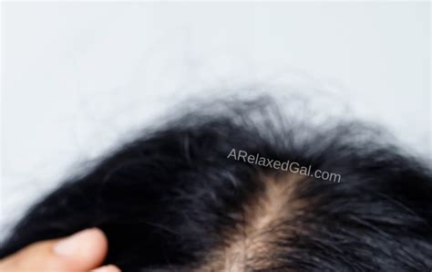 Ways To Include Scalp Care Into Your Relaxed Hair Regimen A Relaxed Gal
