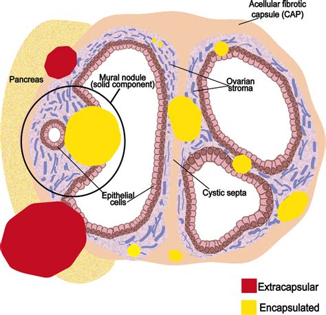 Diagram Illustrating The Classification Of Invasion Patterns Measured Download Scientific