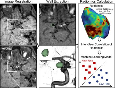 Radiomics Feature Extraction Using The Registered Nonenhanced Magnetic Download Scientific