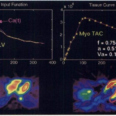 figure3 generation ofnoninvasive input function fromdynamic h2150
