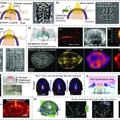 Pdf Photoacoustic Computed Tomography For Functional Human Brain Imaging