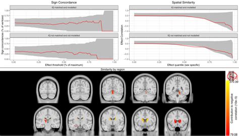 Quantitative And Qualitative Sex Modulations In The Brain Anatomy Of Autism Biological