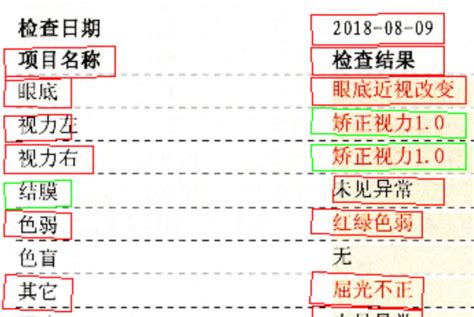 检测结果有缺失 · Issue 232 · Eragonruantext Detection Ctpn · Github