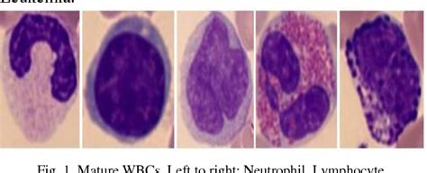 Lymphocytes And Basophils