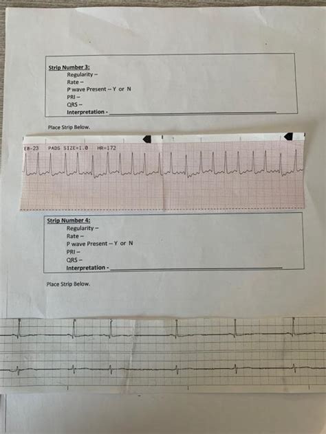 Solved I Need An Answer To This Ekg Stripmore Explaination