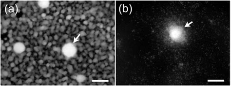 Type 1 And Type 2 Strains Of Mycoplasma Pneumoniae Form Different