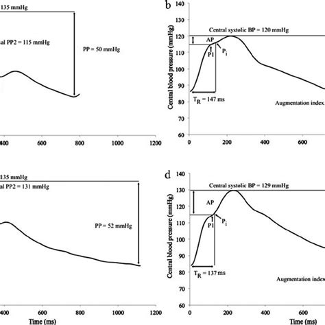 Peripheral And Generated Central Waveforms From 2 Female Participants Download Scientific