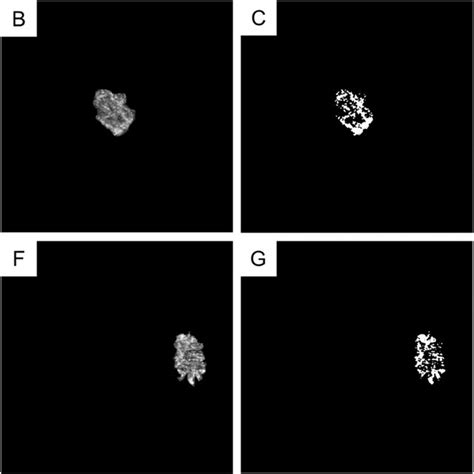 Representative Optical Coherence Tomography Angiography Octa Images