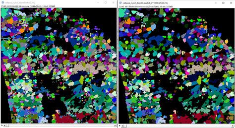 Cell Segmentaion In A Tissue Z Stacks Image Image Analysis Image Sc Forum