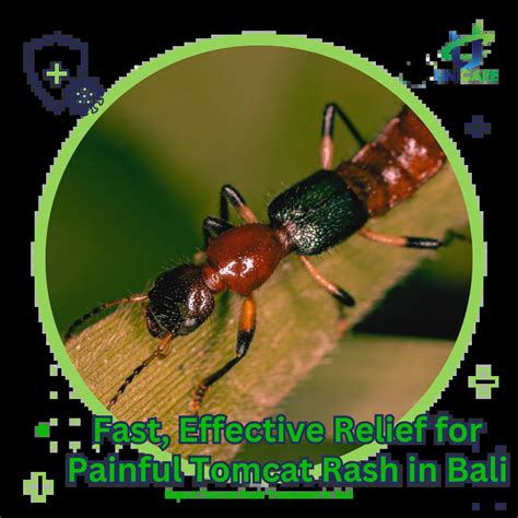 Expert Tomcat Rash Treatment Clinic In Bali Unicare Clinic