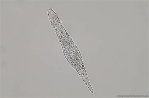 Rotifer Under A Microscope