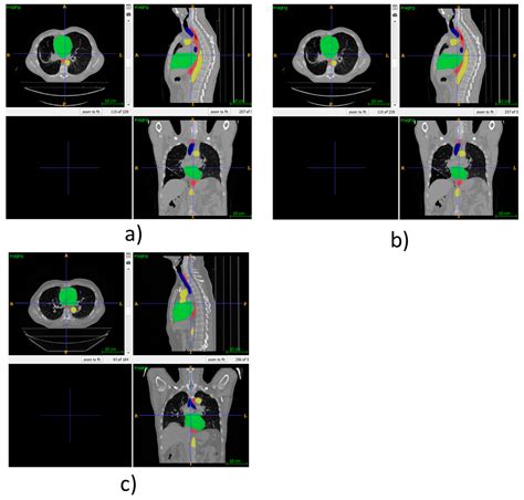 Multi Organ Segmentation Using A Low Resource Architecture