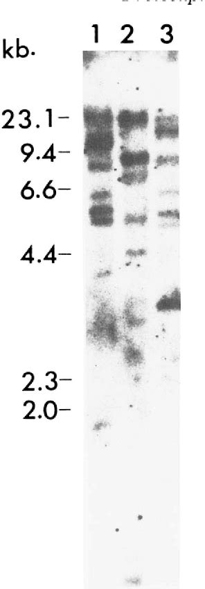 Figure 4 From Molecular Cloning And Sequencing Of Cdnas Encoding The