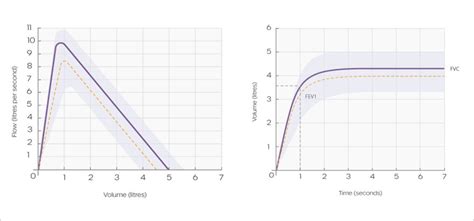 How To Interpret Spirometry Results Amplivox