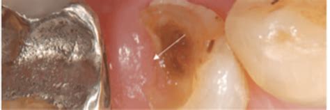 Practice Based Research The National Dental Pbrn