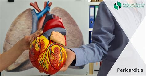 Pericarditis Symptoms And Causes Hti Centers Medical Tourism Center