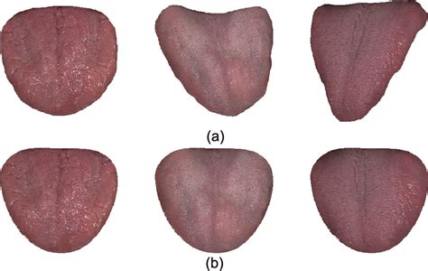 Alignment Results On Samples Of Various Orientations The Original