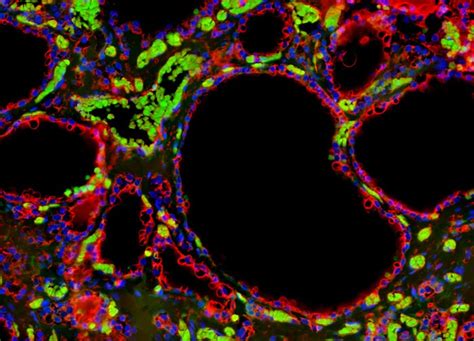 Human Thyroid Gland Tissue Nikons Microscopyu