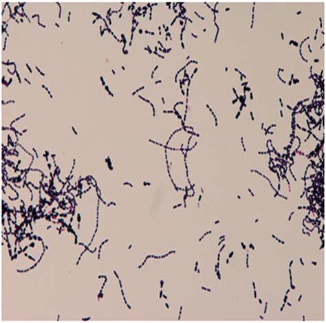 Streptococcus Bovis Identification