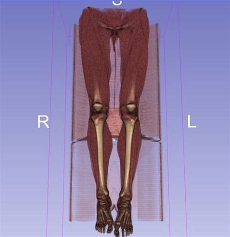 Ct Scan Dicom Files For Instructables Tutorial Tutorials