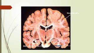 ANATOMY OF CEREBRAL CORTEX LEVY MWANAWASA MEDICAL UNIVERSITY PPT