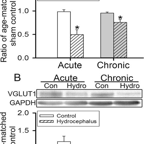 Western Blot Analyses Of Synaptophysin And Vglut1 Expressions In The Download Scientific