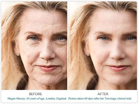 Anti Aging Facial Cream Anti Aging Formular Better Than Botox