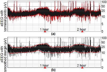 An AEEG Tracing Black With Upper And Lower Margins Red A Download Scientific Diagram