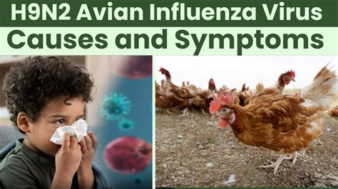 H9n2 Virus What Is Avian Flu Causes Symptoms And Prevention