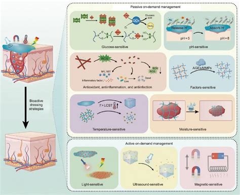 Schematic Illustration Of The Various Microenvironment Sensitive Bioactive Dressing Strategies