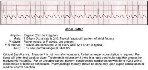 제세동기 Defbrillation과 Cardioversion 네이버 블로그