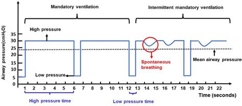 Pressure Longitudinal Axis And Time Horizontal Axis Curve In Aprv Download Scientific