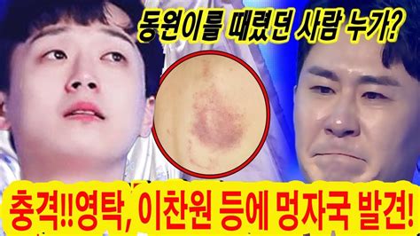 충격 영탁과 이찬원의 등에 멍자국 발견 대체 무슨 일이 이찬원을 때린 범인은 누구 눈물 흘리는 영탁 매니저가 숨긴 충격적인 진실은 Youtube