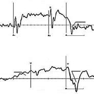General Patterns Of Event Related EEG Potentials ERPs Recorded In The Download Scientific