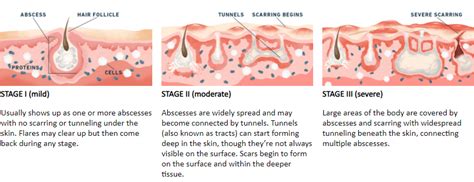 Dermatological Conditions Bellaire Dermatology