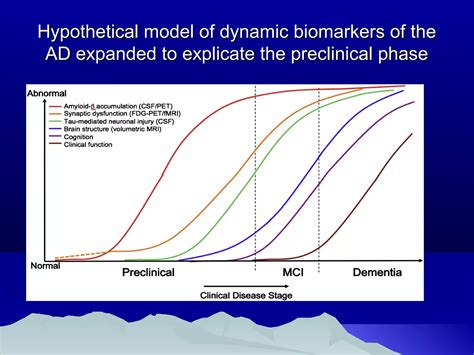 Subjective Cognitive Decline Dr A Keersmaekers Ppt