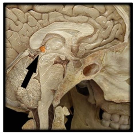 Chapter 13 Multiple Choice Flashcards Quizlet