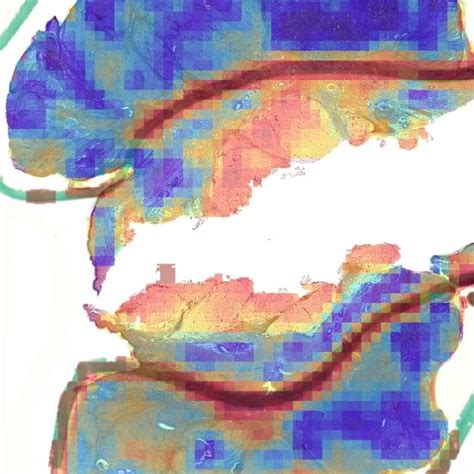 Patch Importance Map Original Image Left Patch Importance Of The