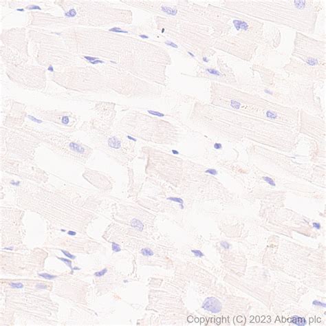 Anti Cd276 Antibody [epr27429 173] Ab313380 Abcam