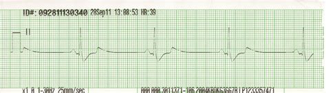 Float Nurse Pediatric Cardiac Arrest PEA