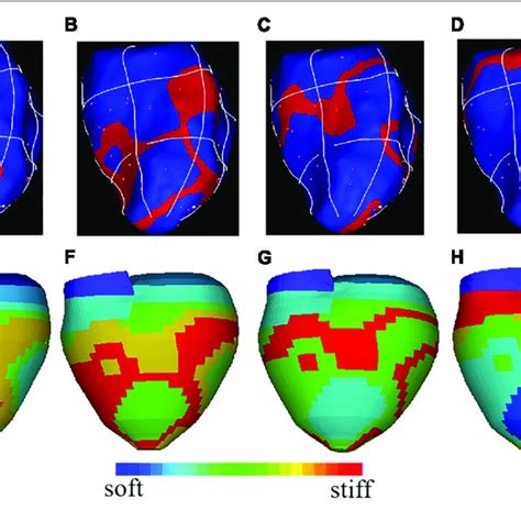 Echo Image Of Right Ventricular Apex Rva Pacemaker Pressure